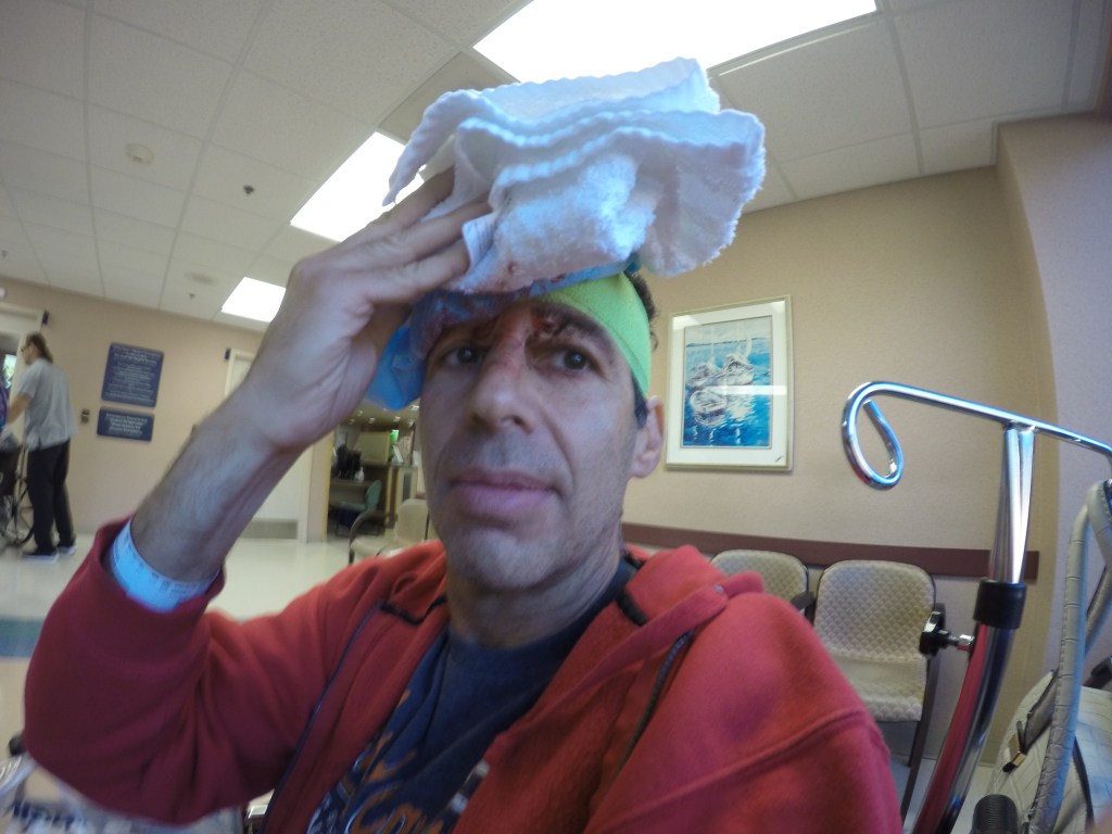 What Happened to Mitch’s Face? A Series of Unfortunate Events ...